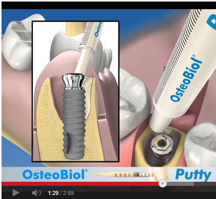 Ostralos - Specialist Clinical Supplies